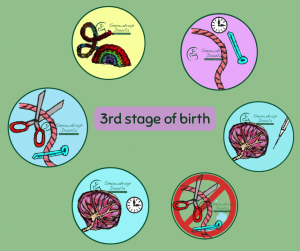 Delayed cord clamping? Options for umbilical cord clamping.